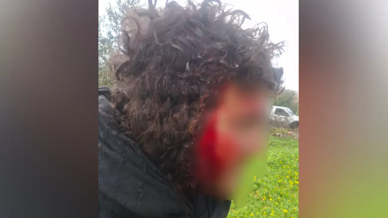 Arab stone-throwing attack caught on camera - Worldnews.com